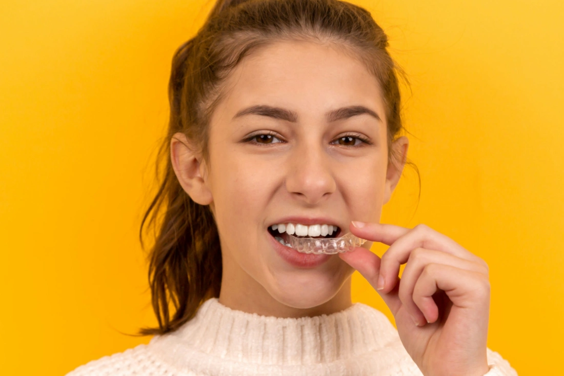 How Do Invisible Aligners Work? | Dental Innovations