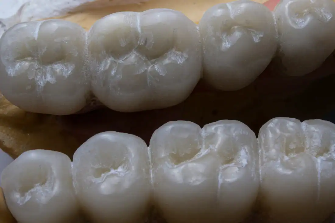 How Long Do Crowns Last? Lifespan, Application, & Care Tips